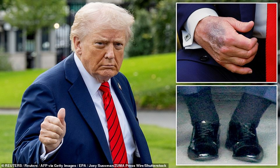Report: Trump's doctor declares 'exceptional overall health' after checkup