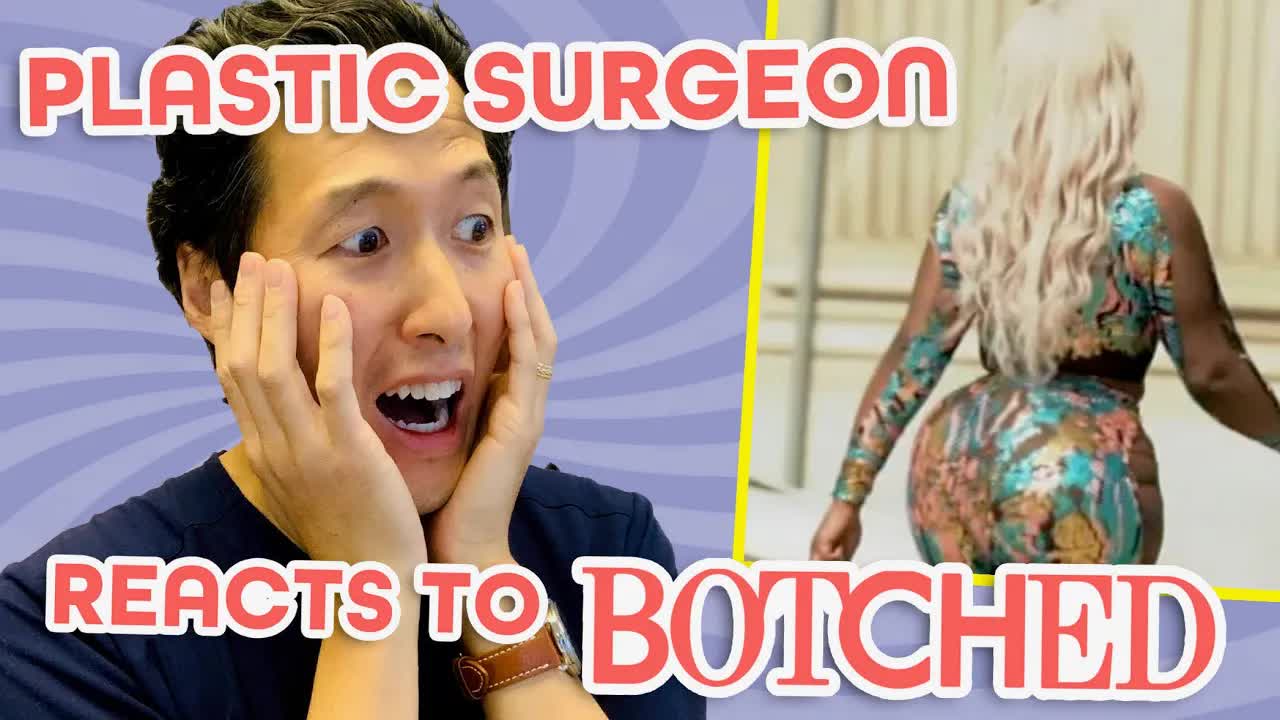 Plastic Surgeon Breaks Down Extreme BBL Cases from Botched