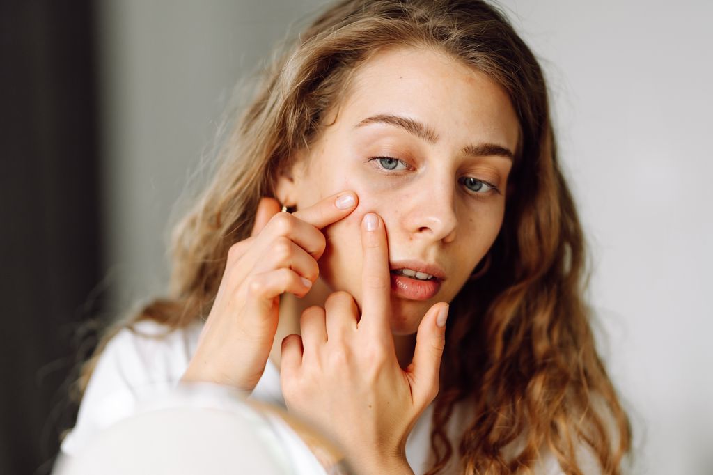 How to get rid of milia - expert tips to banish white bumps and reveal ...