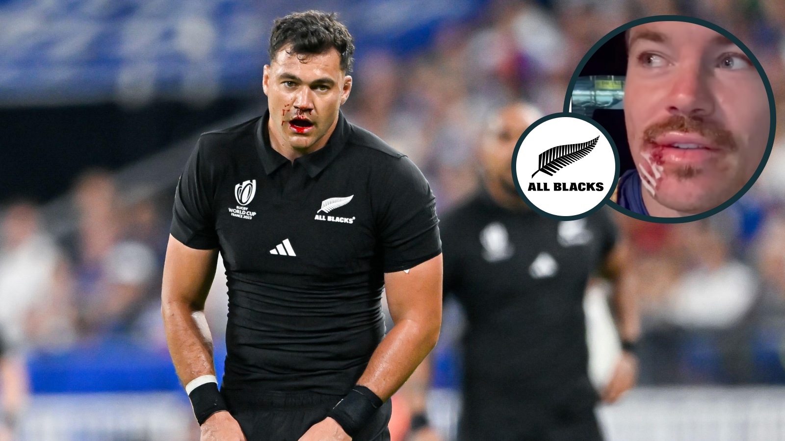 How tackling an All Black led to ghastly ‘never very fun’ injury that ...