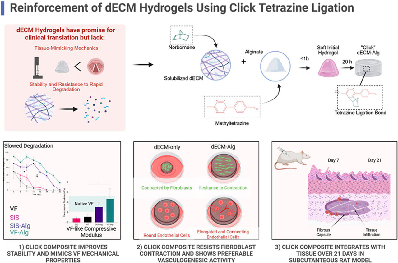 New injectable gel shows promise as voice loss treatment
