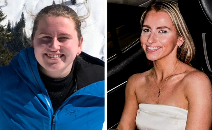 12 People Who’ve Changed So Drastically, It’s Hard to Believe They’re ...