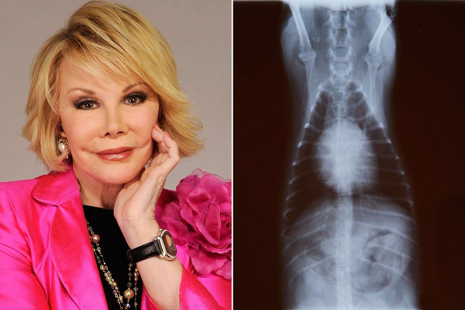 Joan Rivers’ Estate Auctions Off Her Shag Wigs, Dog’s X-Rays and These ...