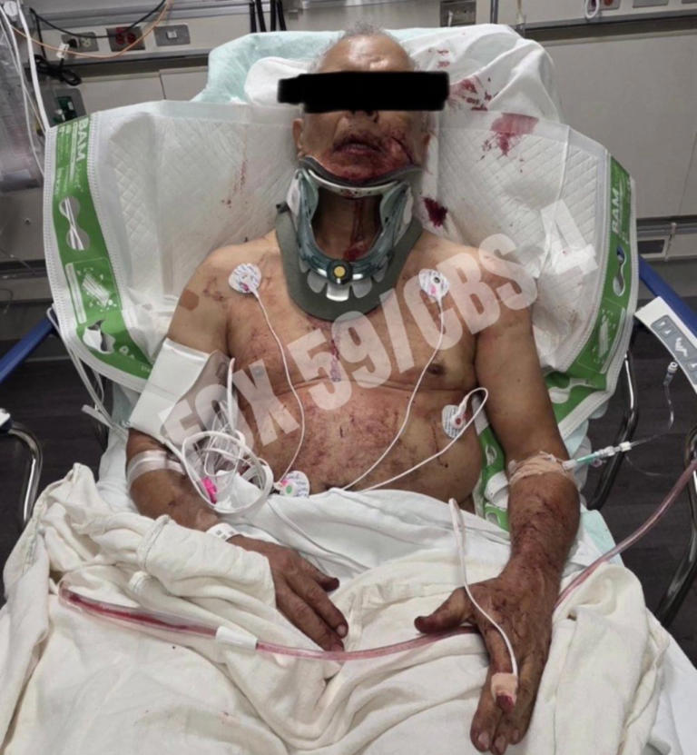 Ex-Jet Mark Sanchez ignores question about bar assault victim in first ...