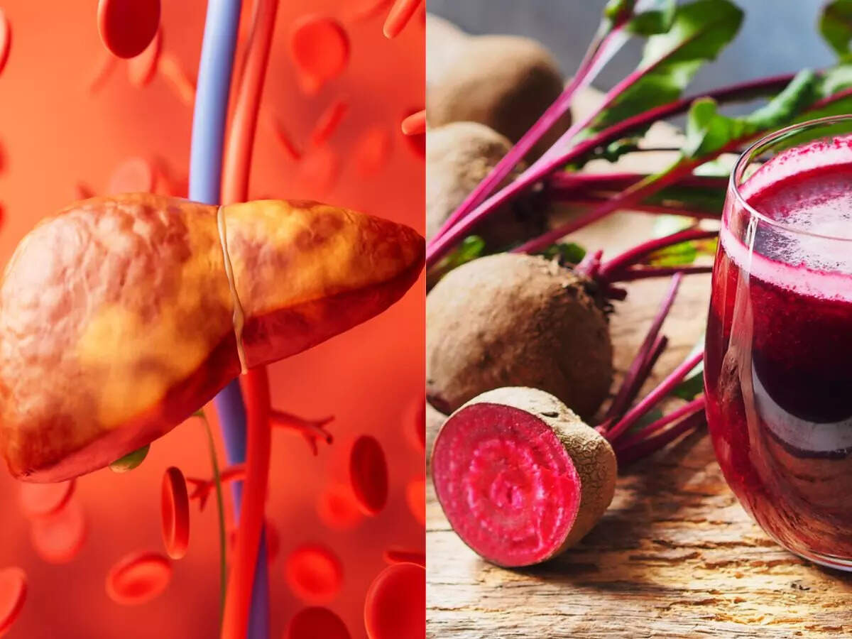 Fatty liver: 3 vegetables that can heal the liver naturally