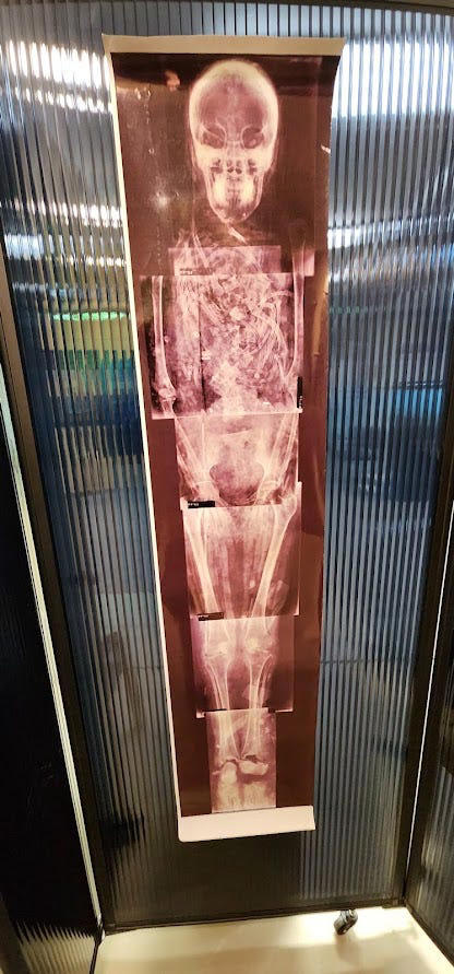 Richmond mummies survive in afterlife despite 20th-century fire, lack ...