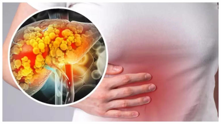 Alia Bhatt lost weight with Intermittent Fasting; US doctor shares if ...