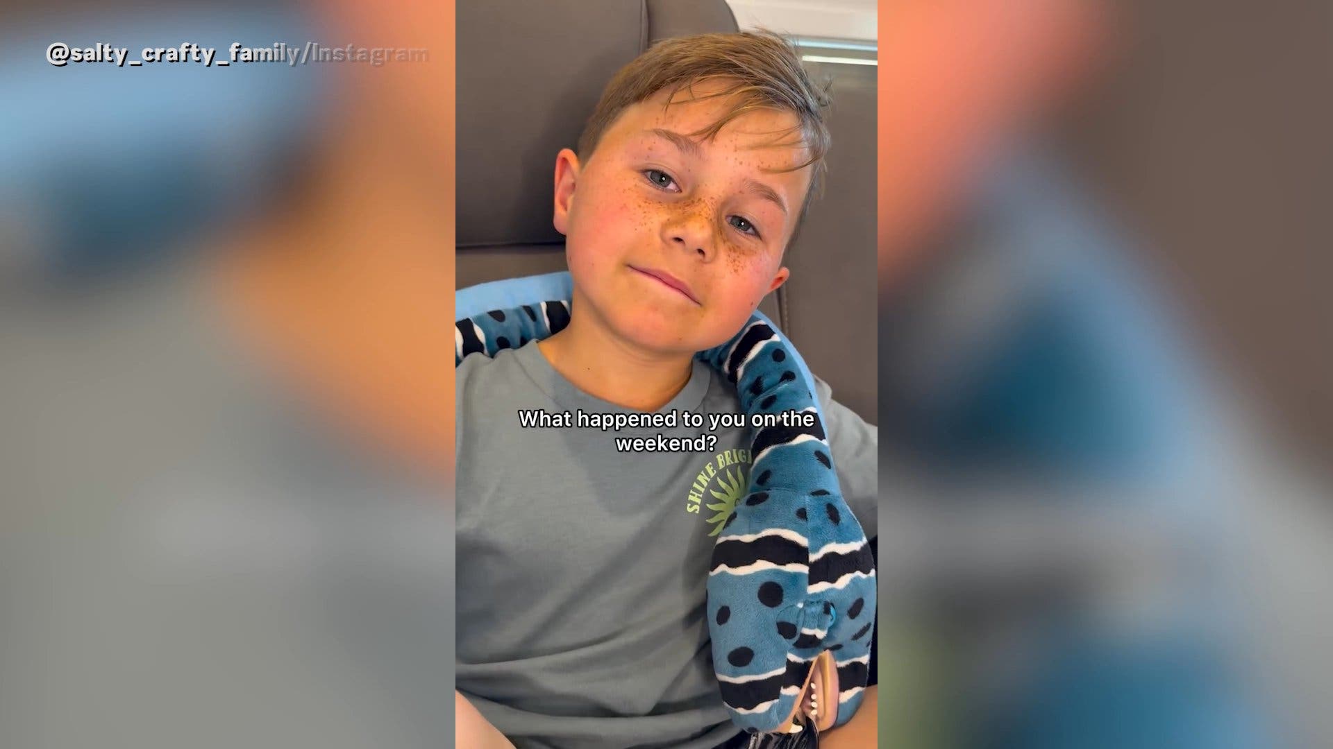Boy, 7, Bitten On Head By Python During Birthday Party: ‘Happened So Fast’