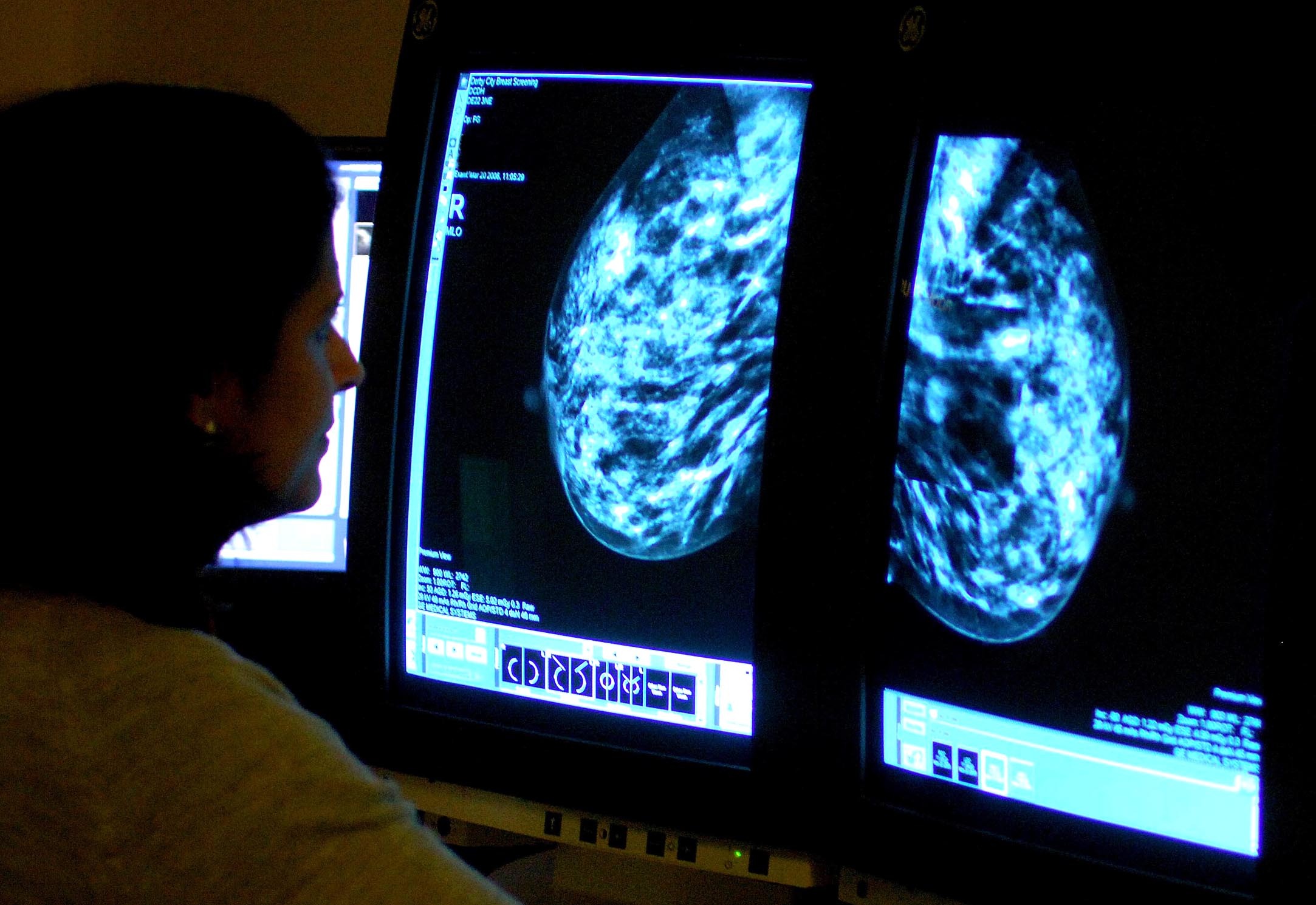 'Deeply unfair': Anger as breast cancer patients in Scotland denied ...