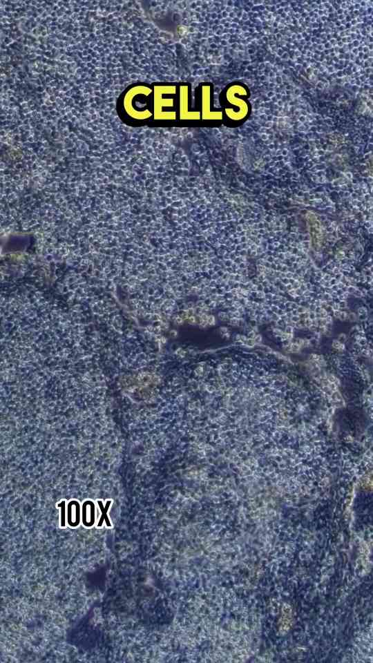 Pimple Pus Under the Microscope — You Have to See This!