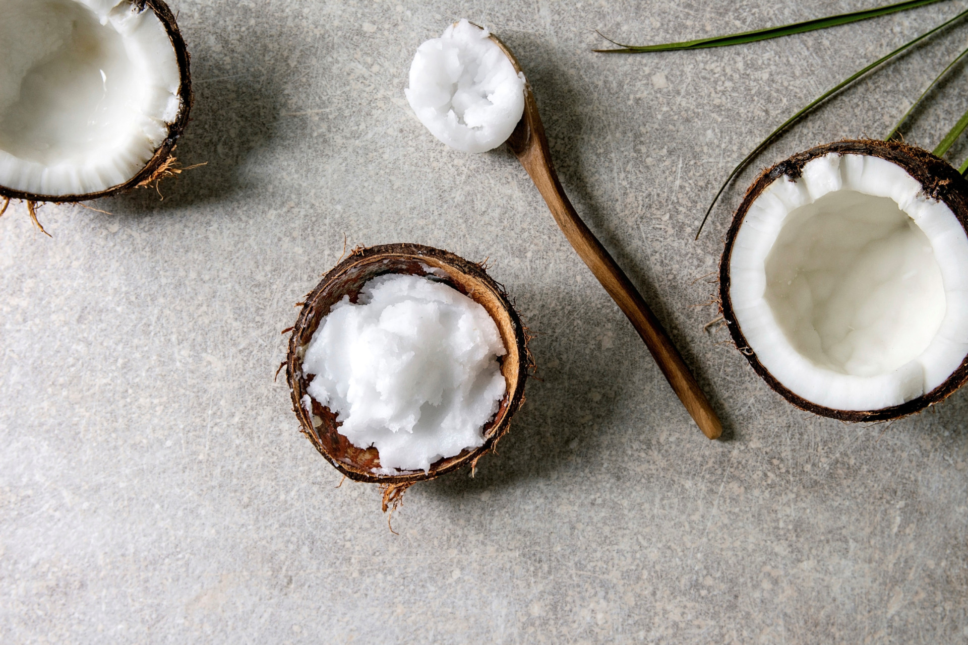 Natural antibiotic foods to add to your diet