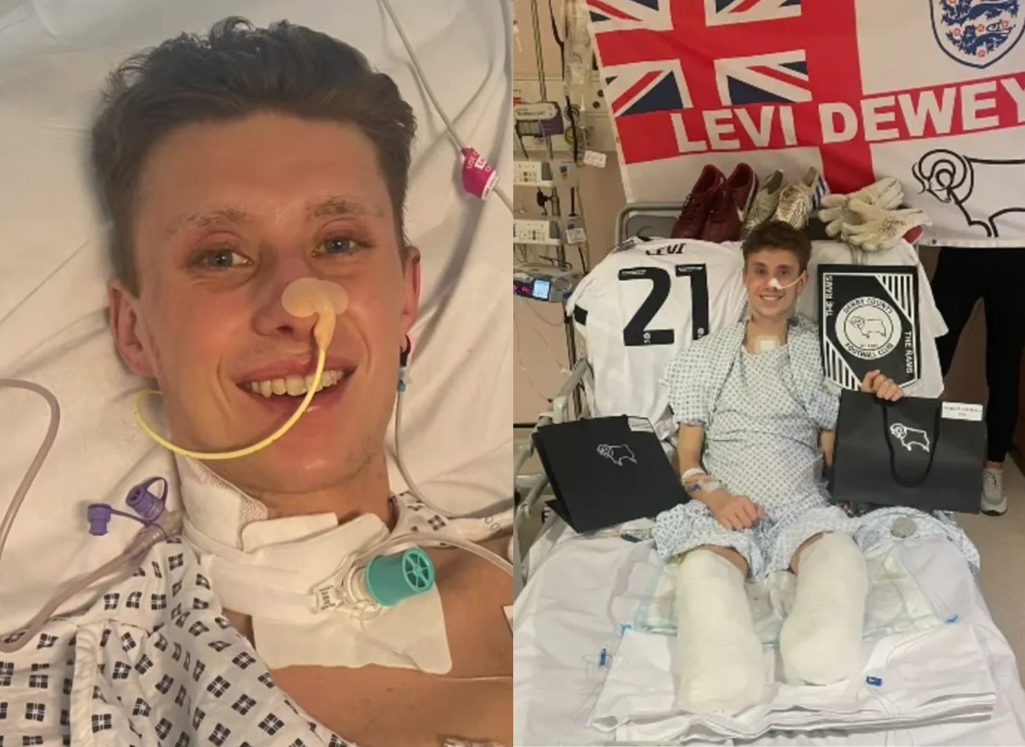 Jovem tem pernas amputadas após ser diagnosticado com gripe: "Quase ...