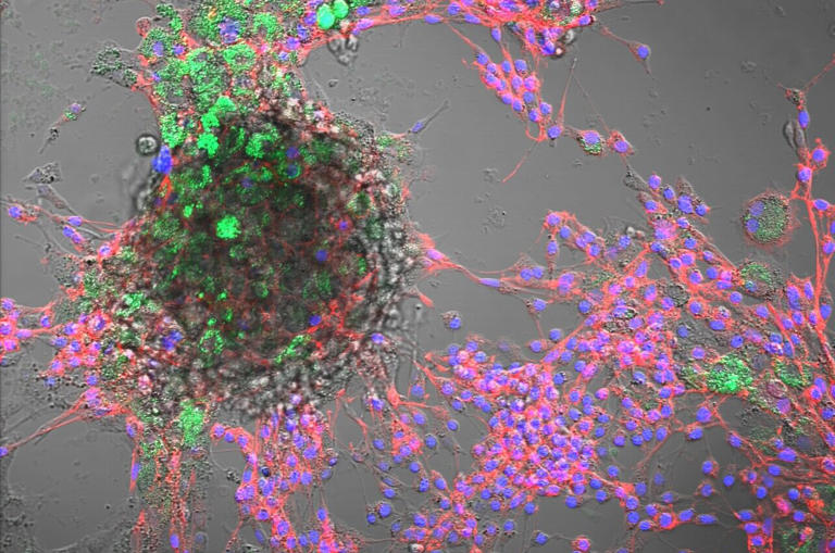 Nanoplastics detected in farm animal cells: Study warns of possible ...