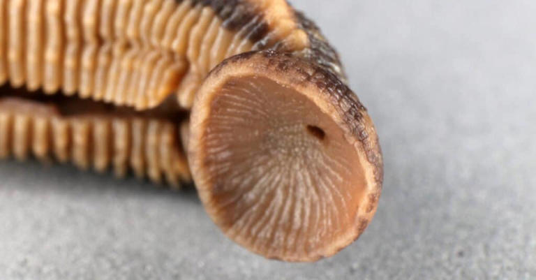 What to Do If a Leech Attaches to You