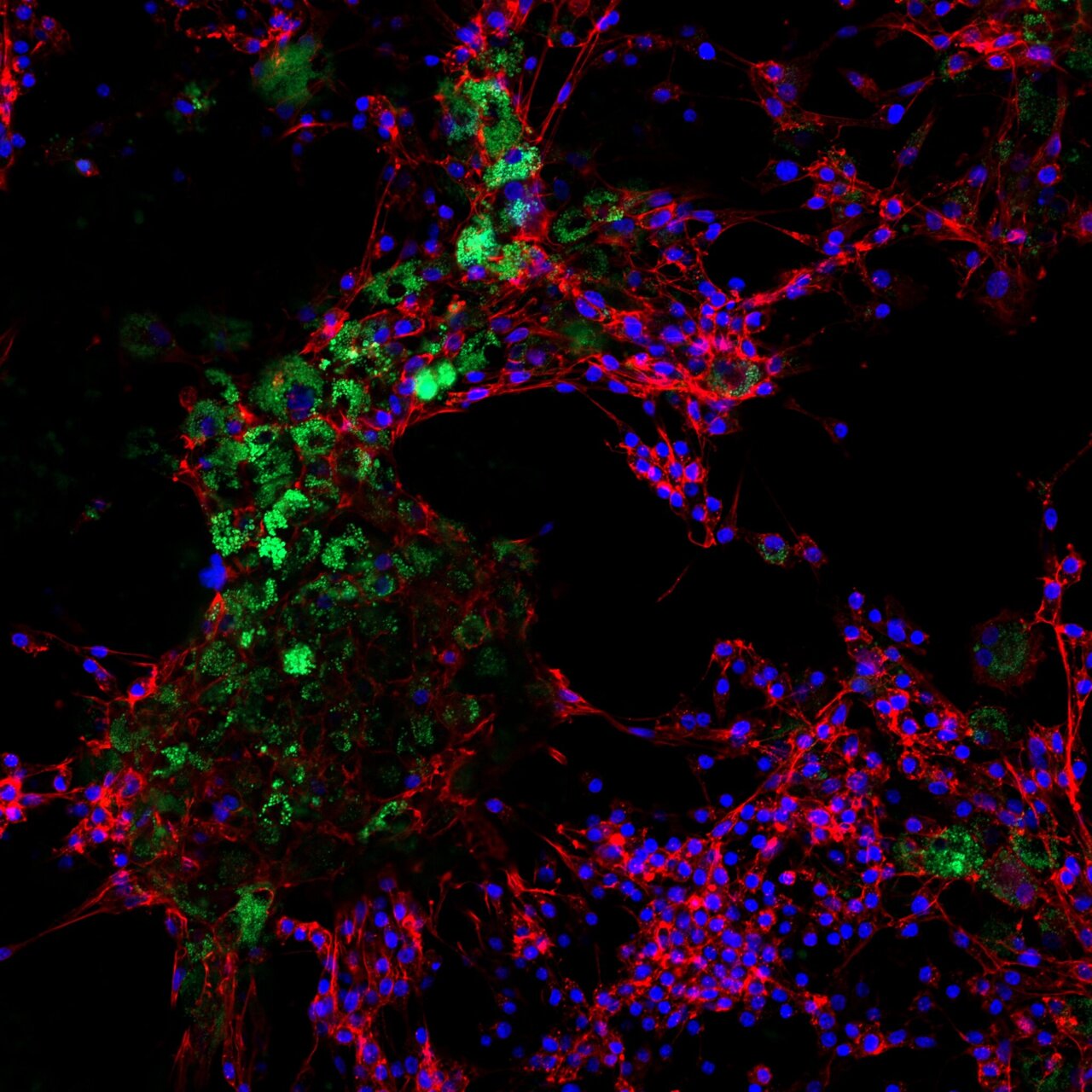 Nanoplastics detected in farm animal cells: Study warns of possible ...