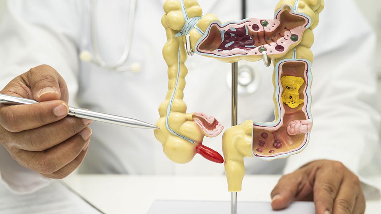 Why Your Appendix Might Be More Useful Than You Think