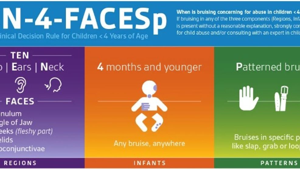 Ten-4-FACESp rule aids in earlier intervention for young child abuse ...