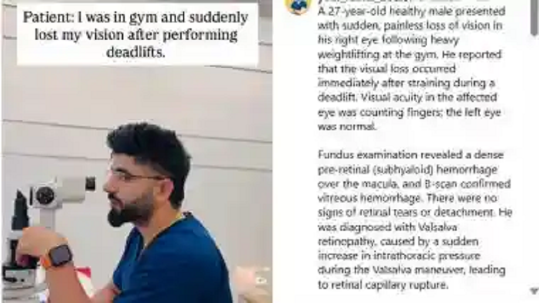 VIDEO: Young man suffers from Valsalva Retinopathy, loses eyesight ...