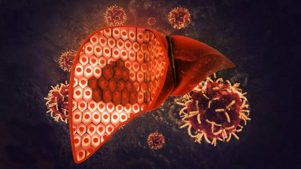 Liver cancer: Not lack of appetite, but these are the early symptoms of ...