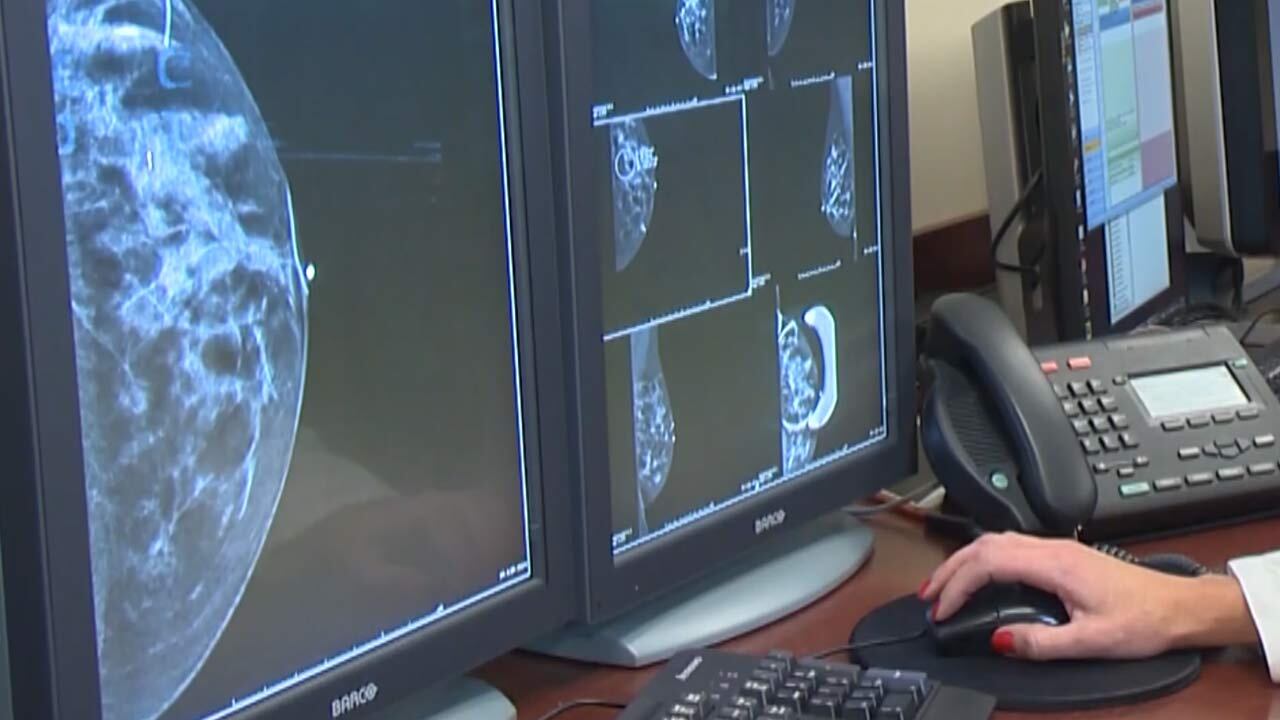 Wisconsin State Senate passes ‘Gail’s Law’ to expand coverage of breast ...