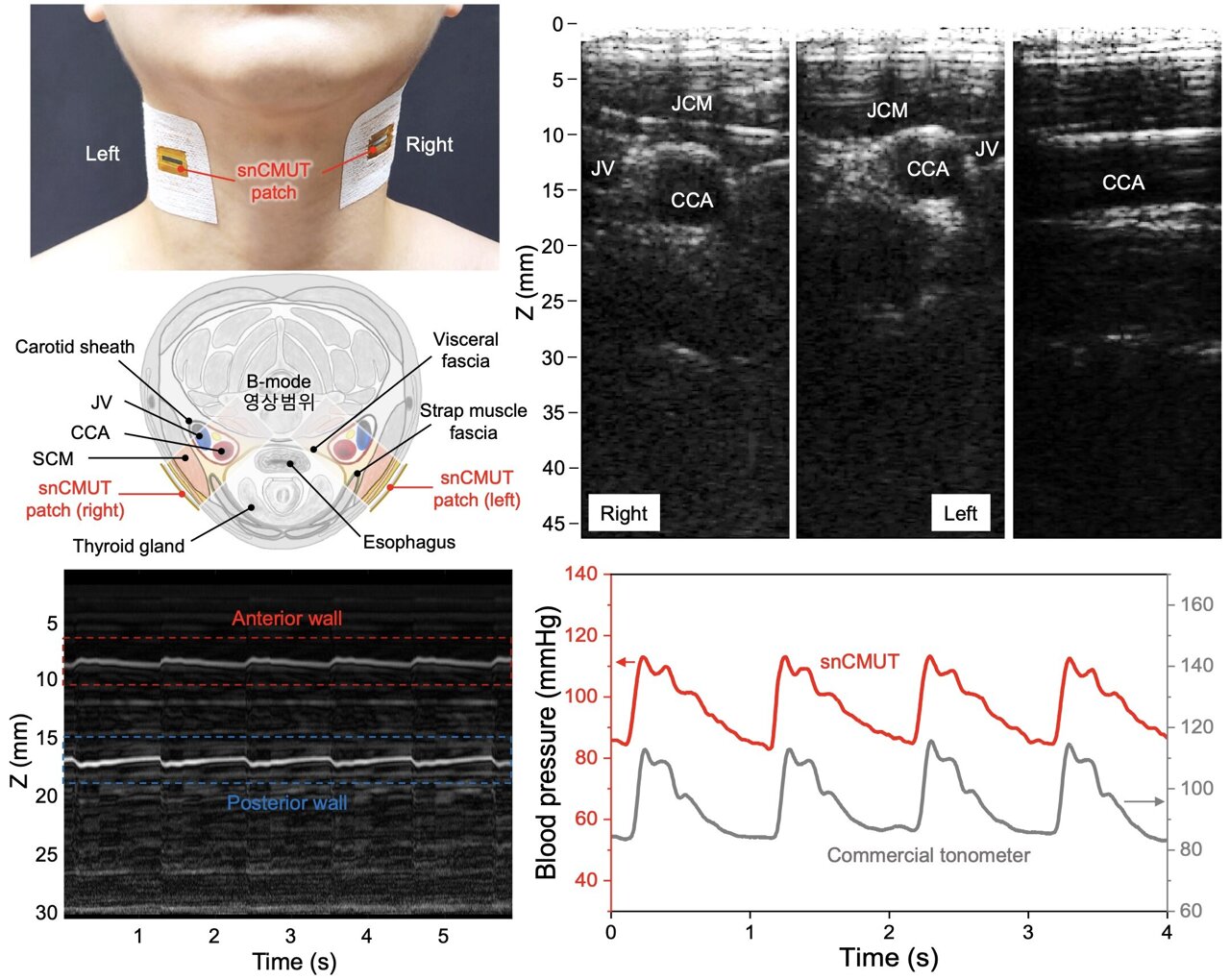 Eco-friendly silicon patch delivers clearer ultrasound images without ...