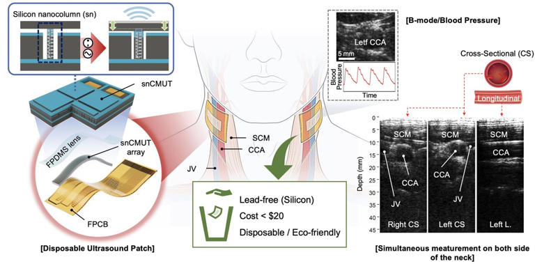 Eco-friendly silicon patch delivers clearer ultrasound images without ...