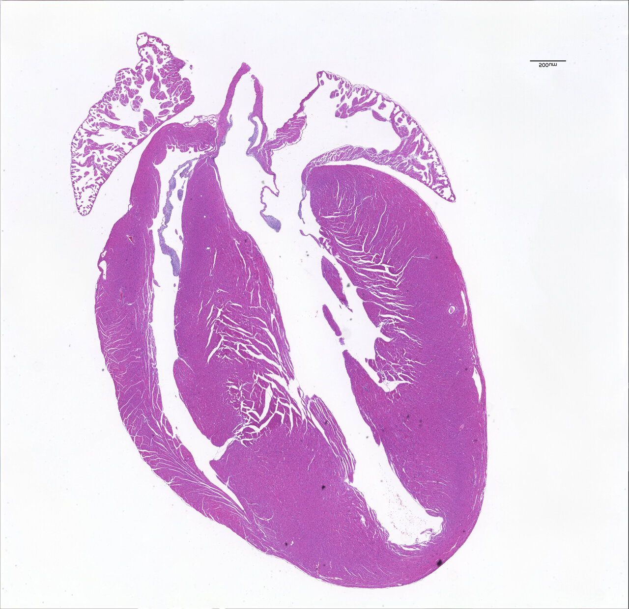Precise gene editing technique changes one DNA base to correct heart ...
