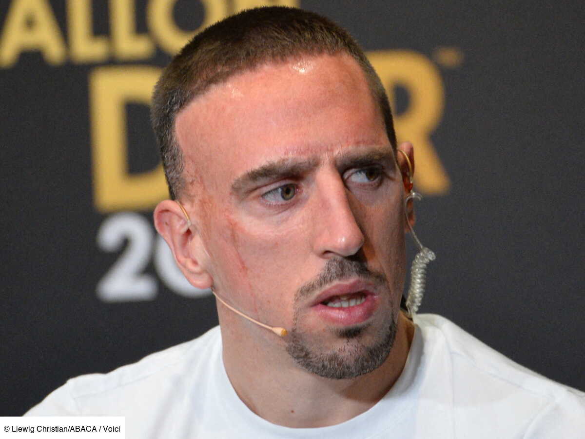 Franck Ribéry passé à travers le pare-brise : cet accident avec son ...