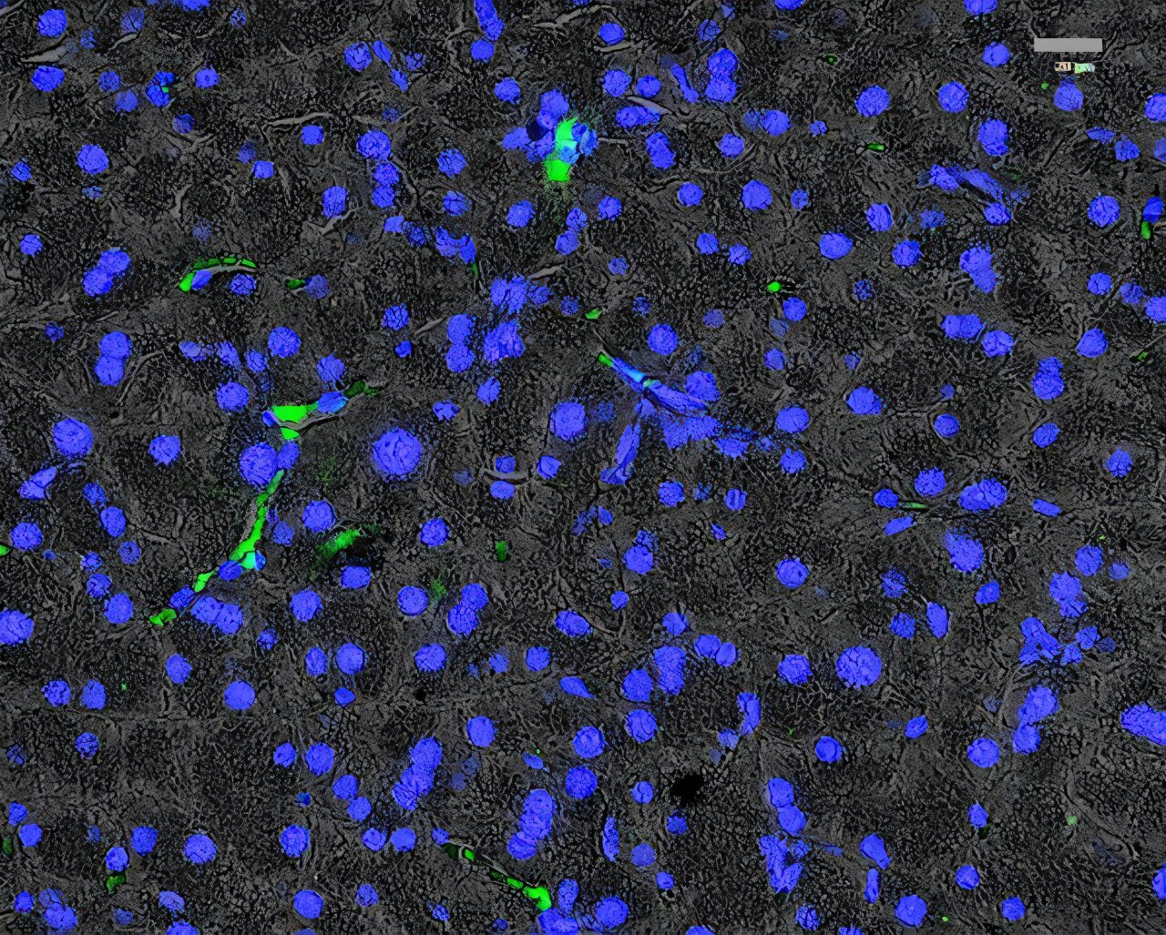 New insights into the role of stellate cells and blood vessels in the ...