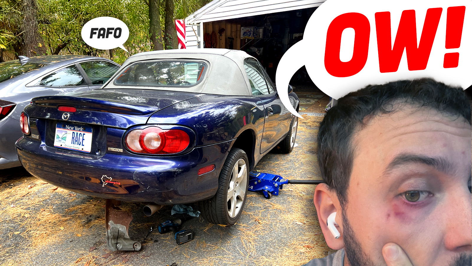How My Mazda Miata Gave Me A Black Eye