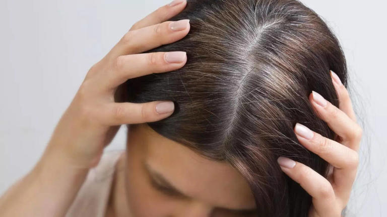 Gray hair reversal: How much of natural hair color can actually be ...