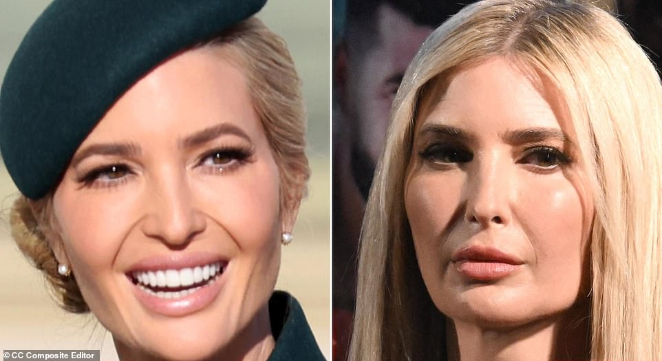 Plastic surgeons reveal what's behind Ivanka Trump's new face