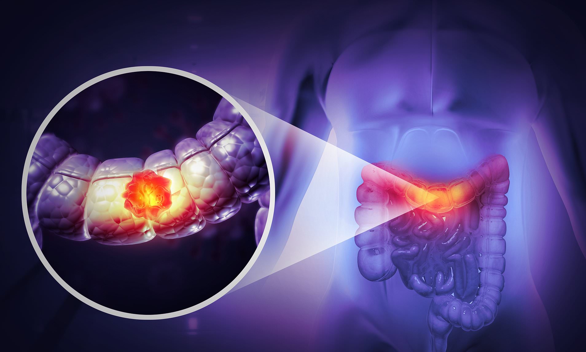 Top doctor reveals simple DIY method that can show if your bowel ...