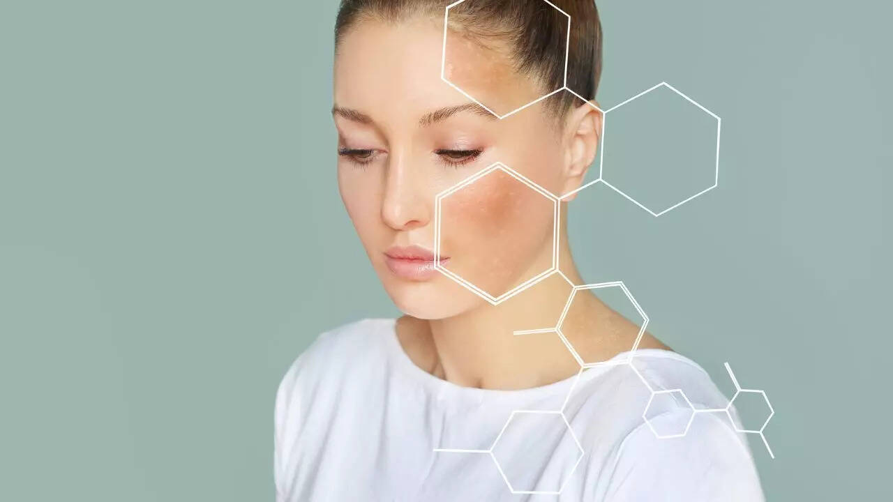 Dark patches on your skin? Acanthosis nigricans could be a warning sign ...