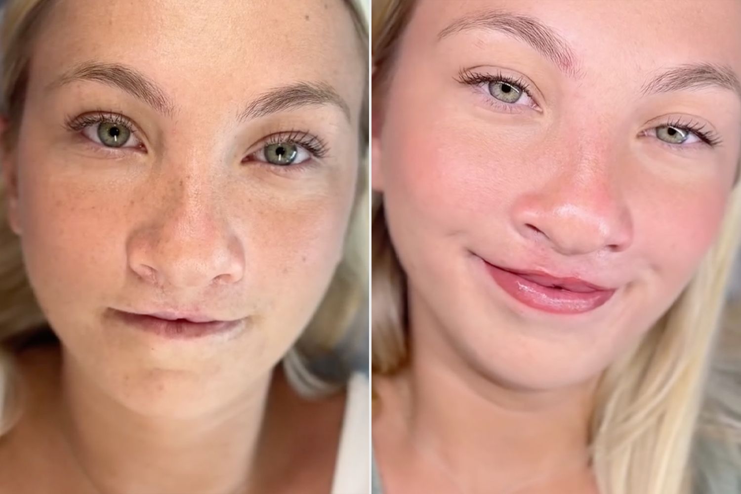 Woman, 24, Underwent 20 Surgeries for Her Cleft Lip. Then This Tattoo ...