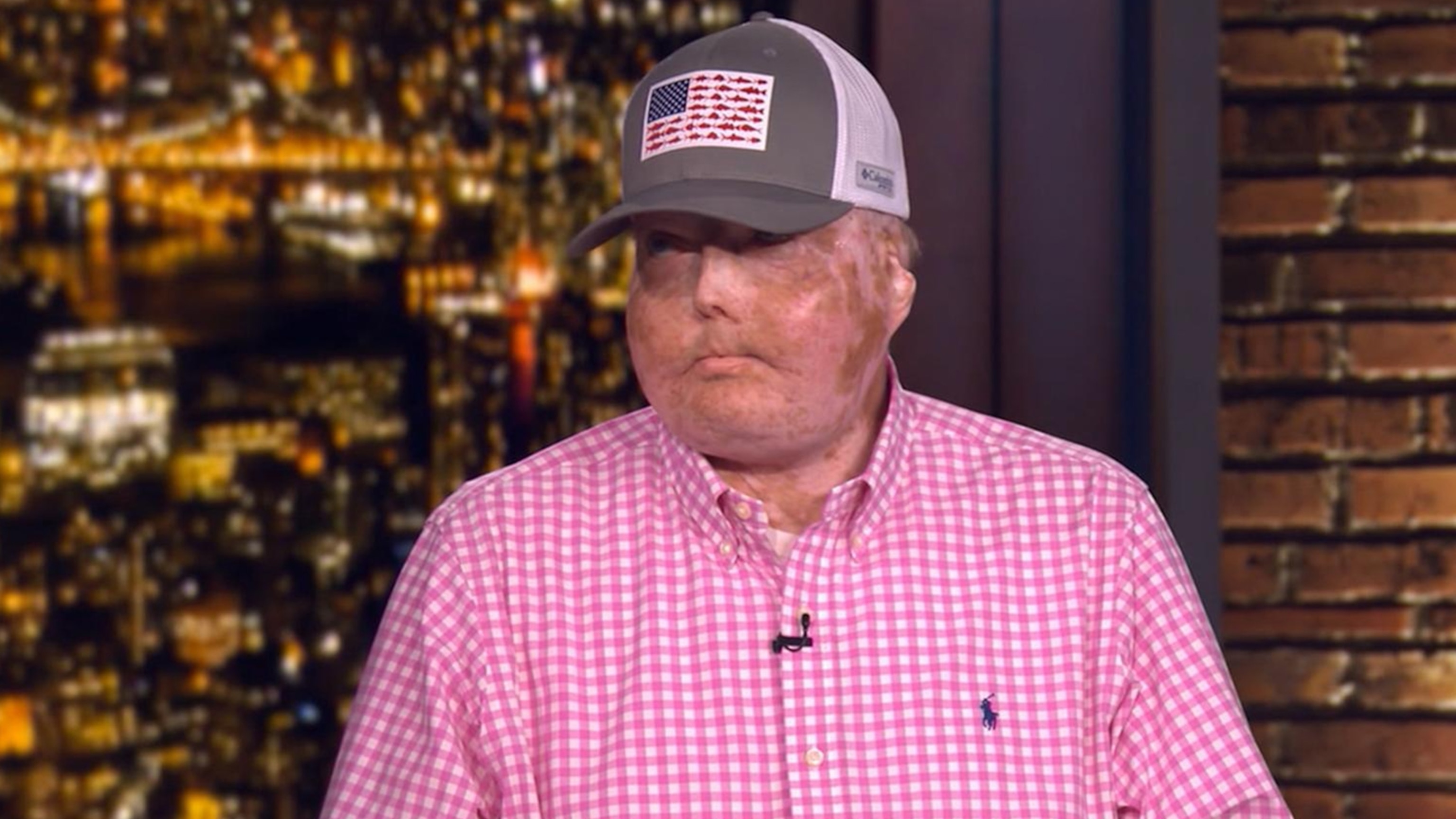 Face transplant recipient Pat Hardison reflects on struggles in new memoir