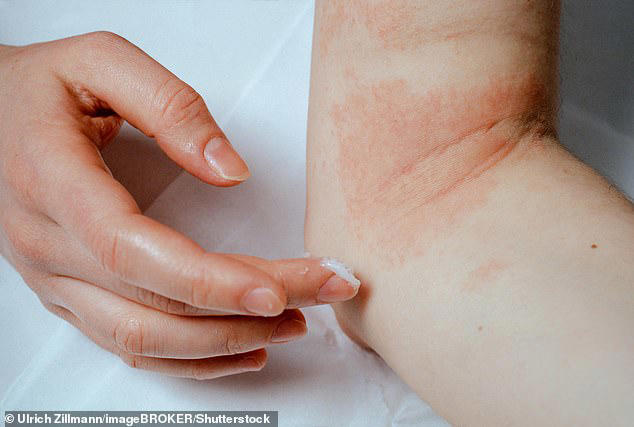 Skin creams prescribed to millions found to have cancer-fighting effects