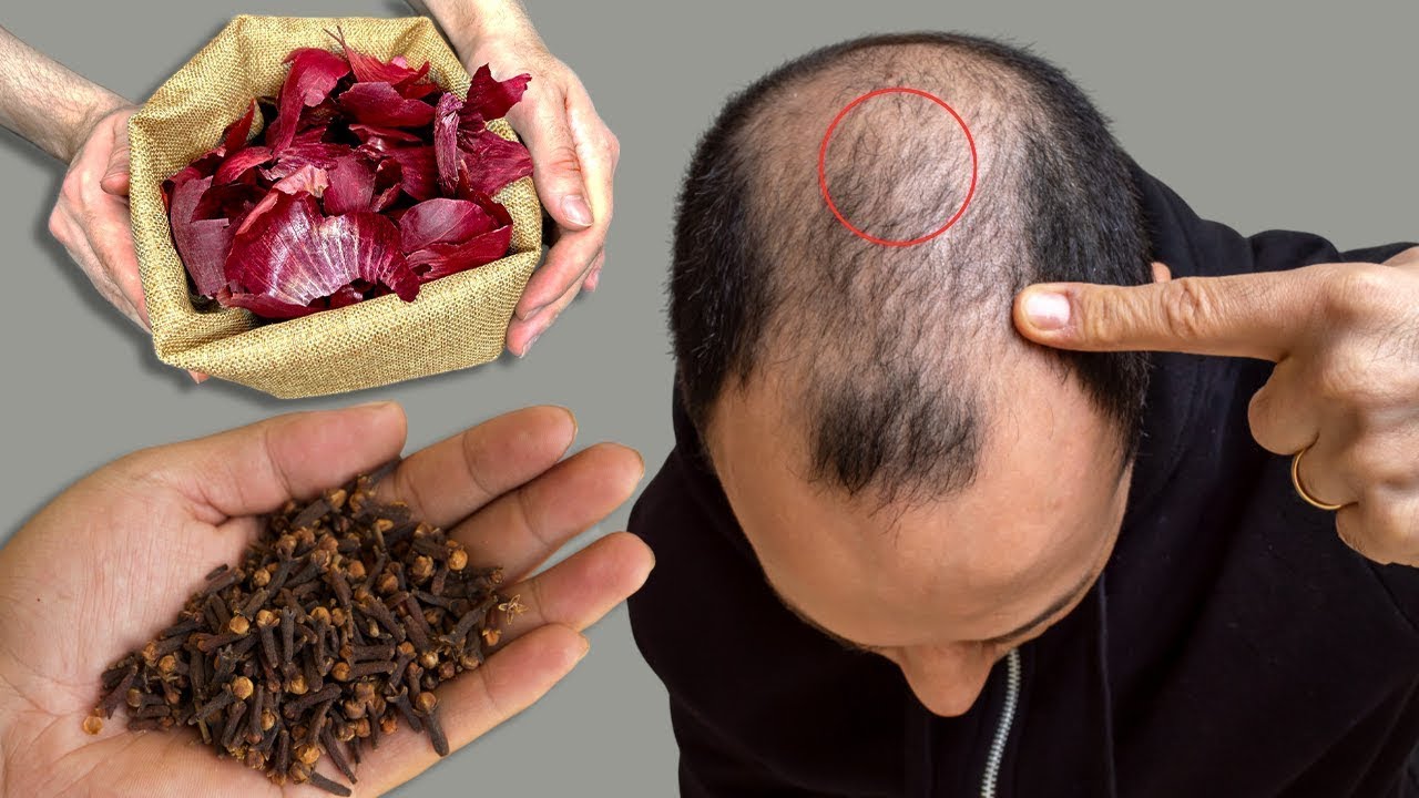 🔥 „ICH HABE NICHT GEGLAUBT, DASS ES FUNKTIONIERT … Meine Haare sind in ...