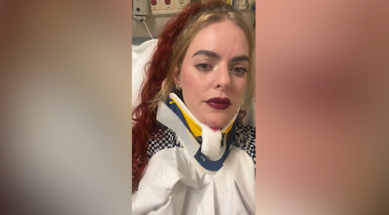 Woman Gets In Car Accident—And Lipstick Doesn’t Budge