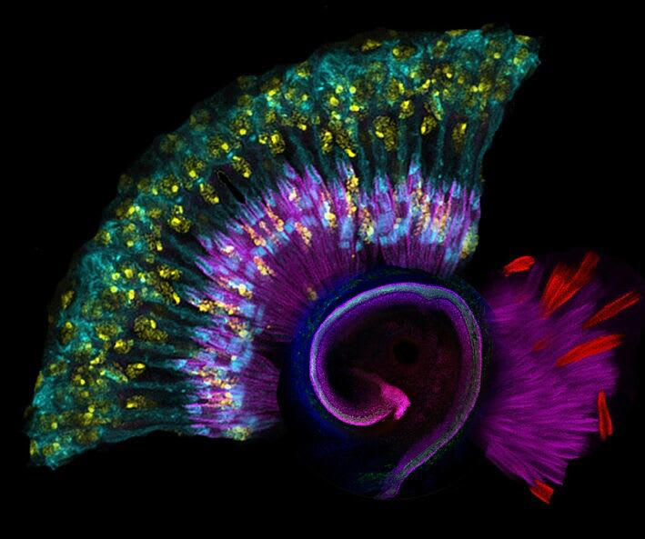 Researchers discover genetic cause of hearing loss and identify ...