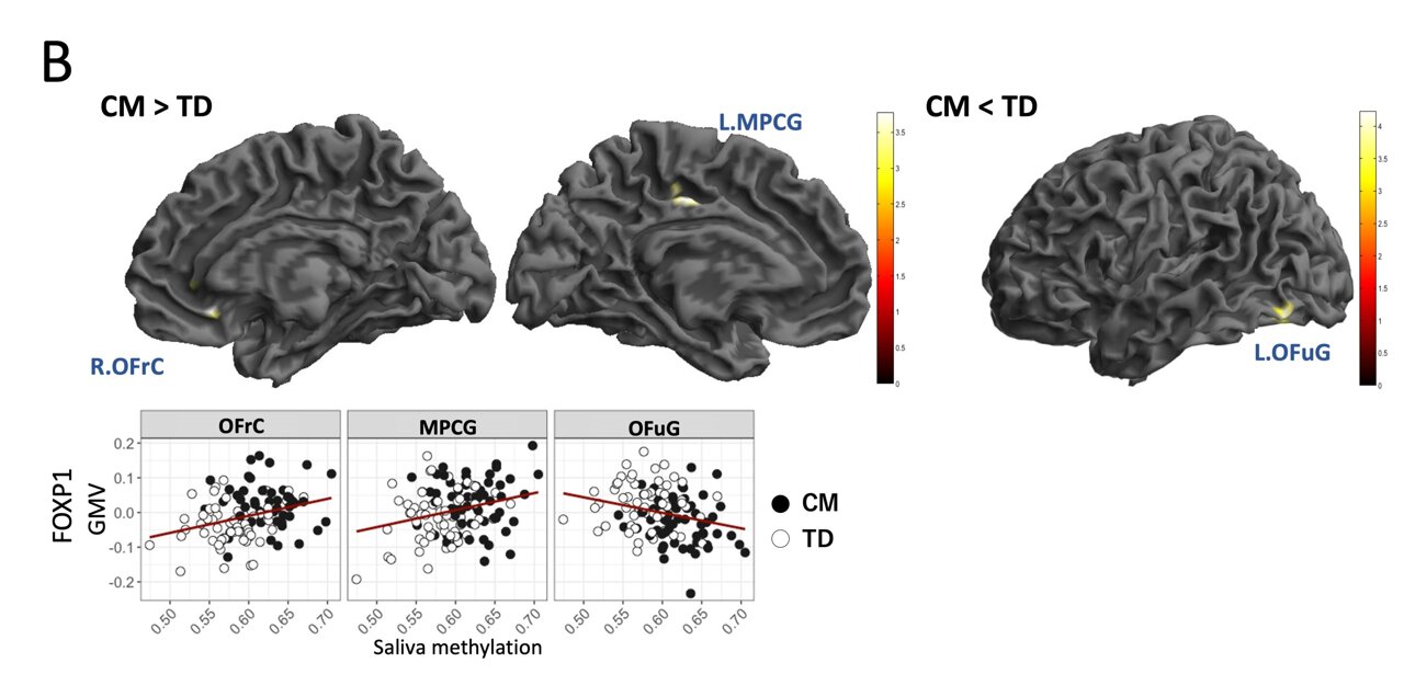 Epigenetic 'scars': Unveiling how childhood trauma affects our genes