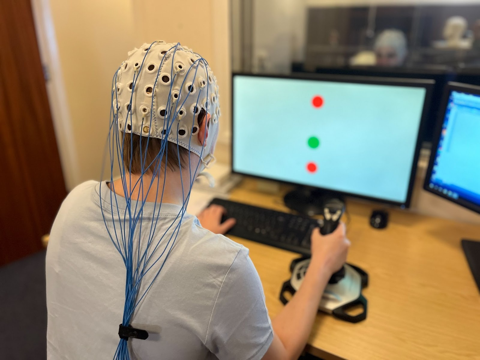 Scientists capture what anxiety looks like in the brain