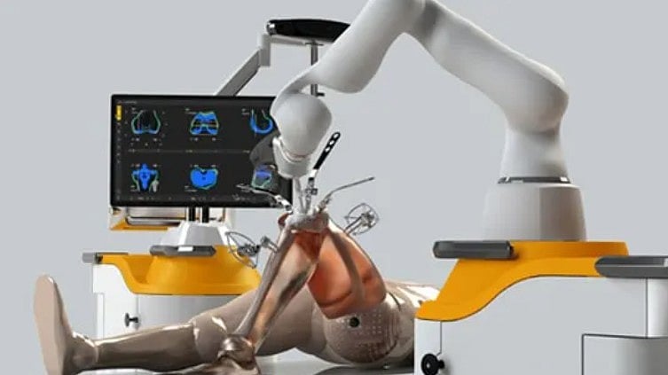 Same-day knee replacement performed at Delhi hospital using Indian-made MISSO robot