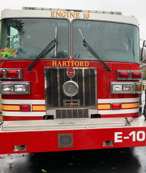 Man suffers burns on hands during kitchen fire in Hartford