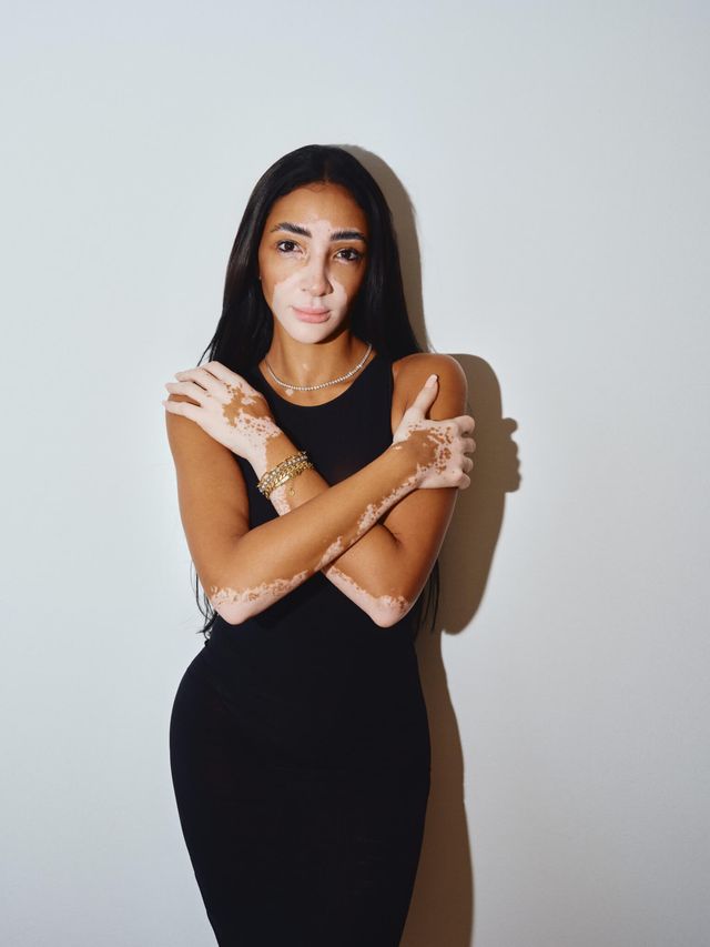 Logina Salah: “La bellezza non è perfezione ma autenticità e coraggio”