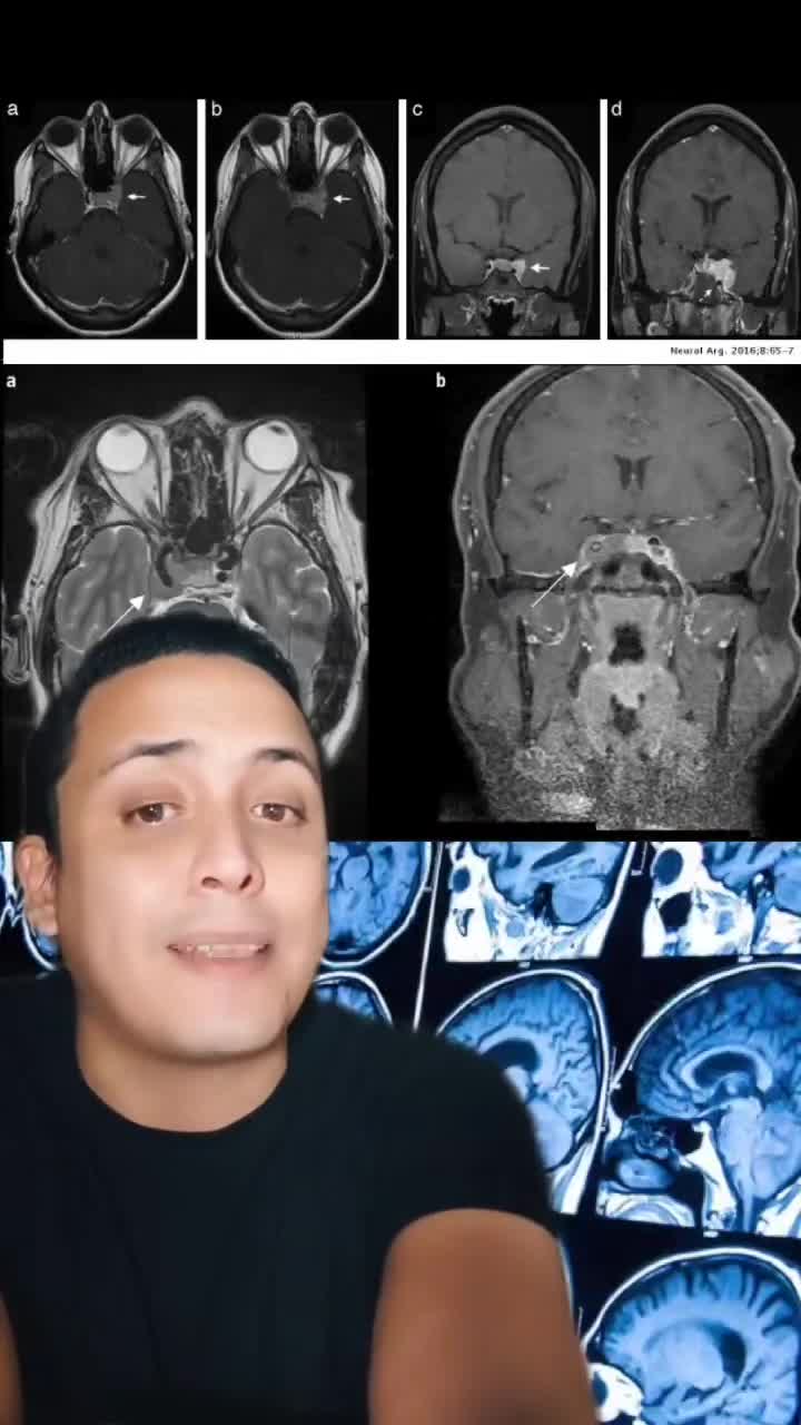 Un extraño caso en Caracas. #historiasasombrosas #nescritor