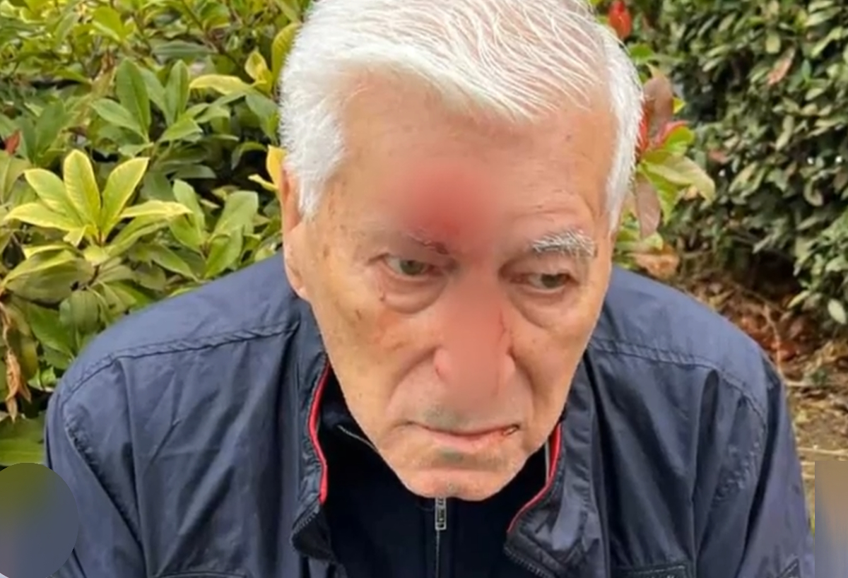 Θεσσαλονίκη: 82χρονος δέχεται επίθεση από γιατρό «μποξέρ» – «Μου είπε ...
