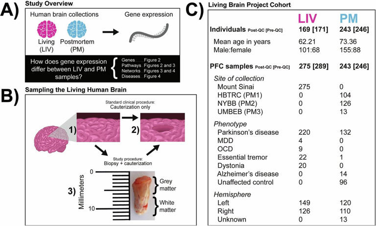 Living brain tissue reveals unique RNA and protein patterns missed in ...