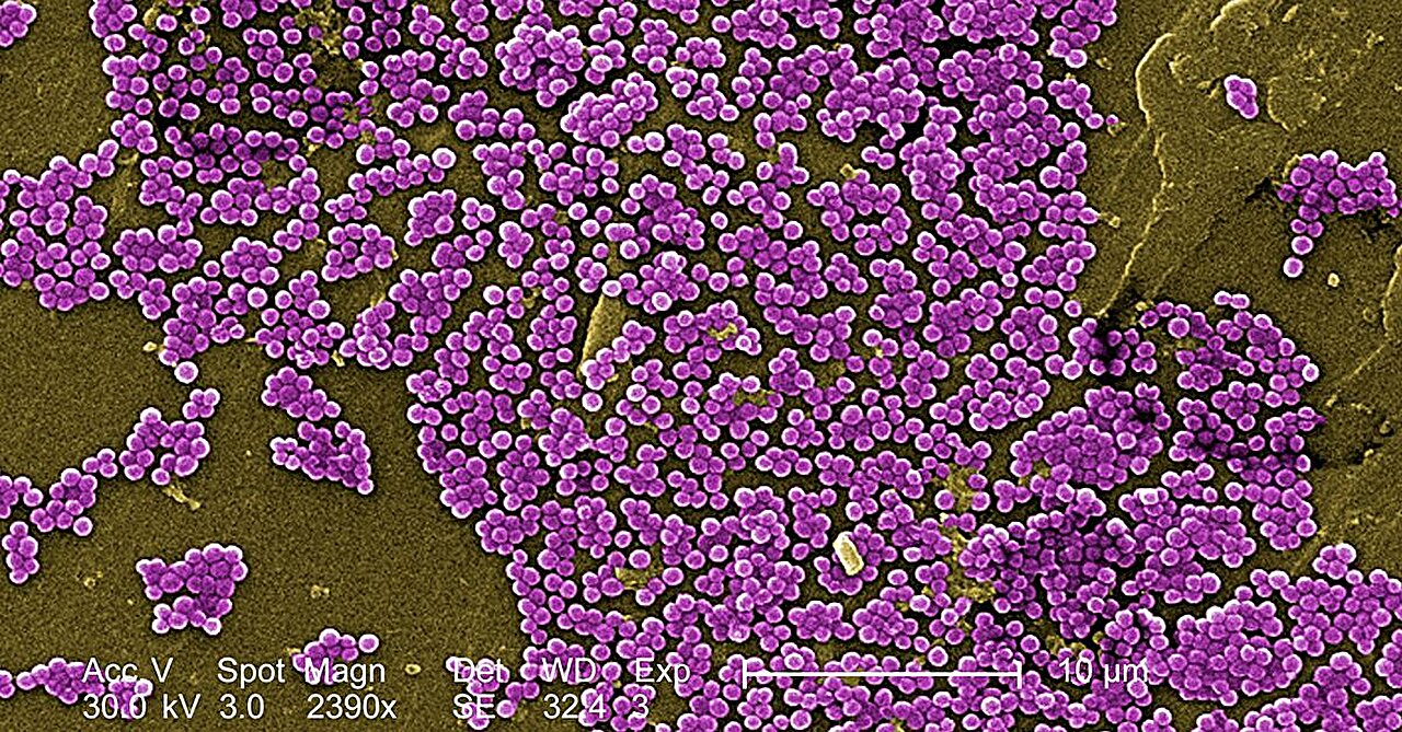 Bacterial communication delays wound healing by disrupting skin cell repair