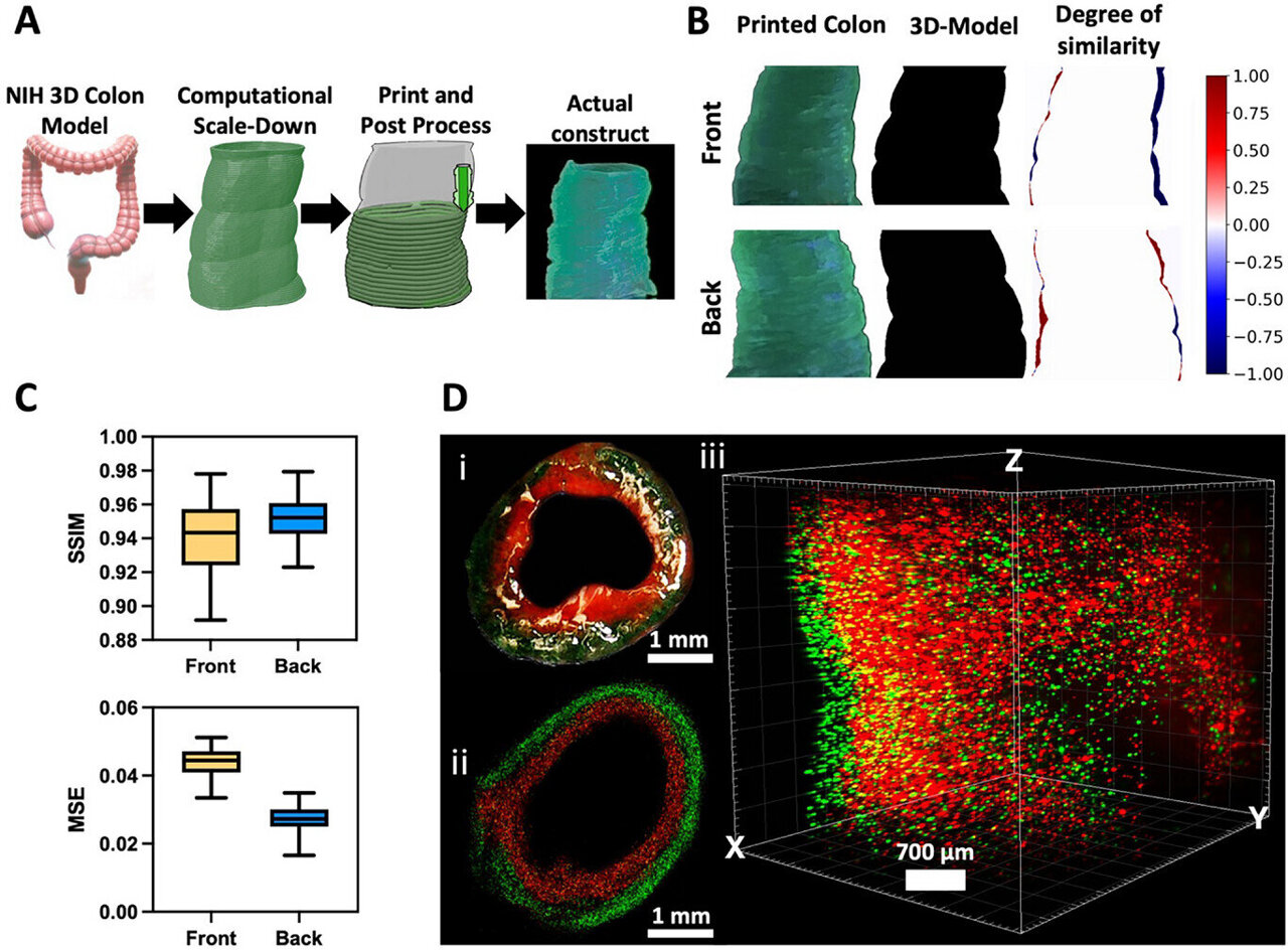 Bioelectronic-integrated artificial colon eliminates need for animal ...
